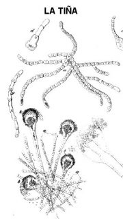 Cómo se contagia la tiña – Botanical-online